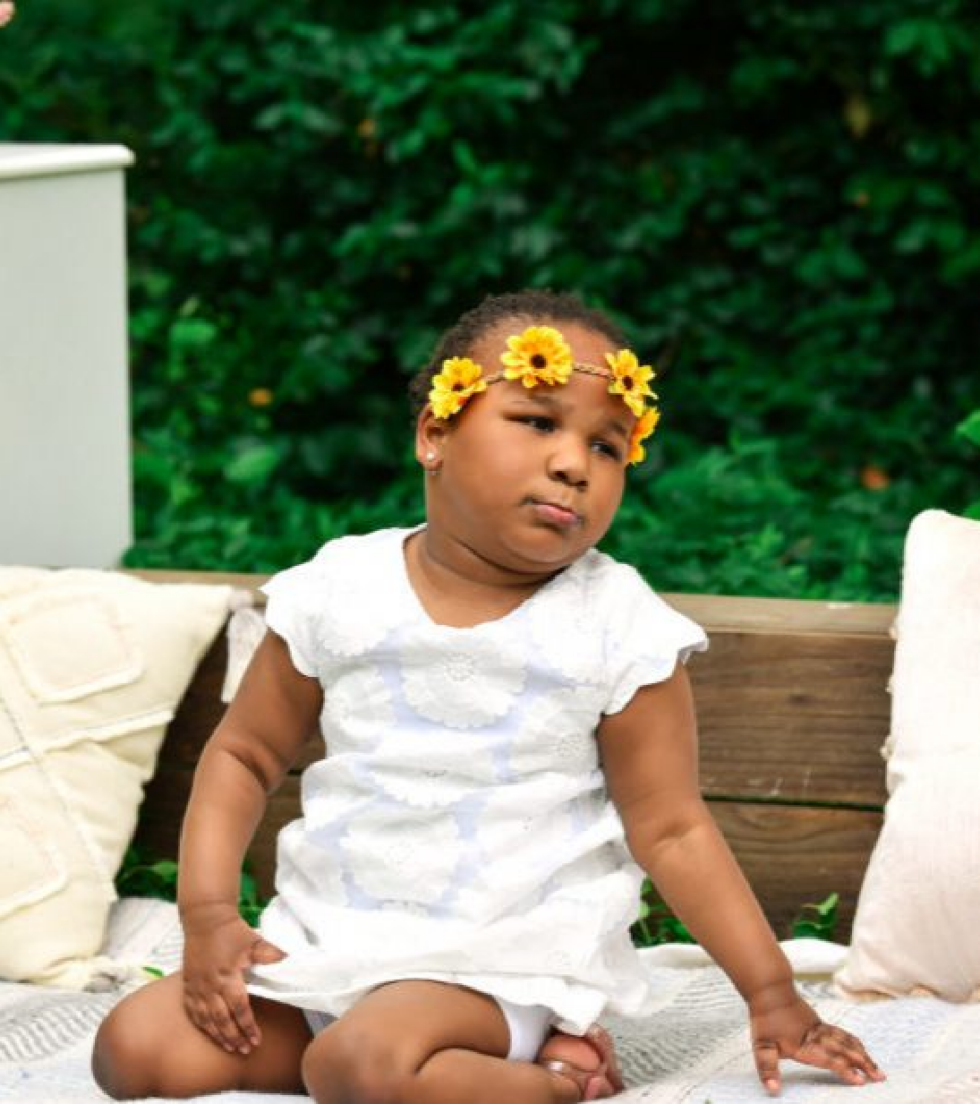 Trisomy 18 Syndrome | Trisomy 13 Syndrome | Trisiomy 9 Syndrome