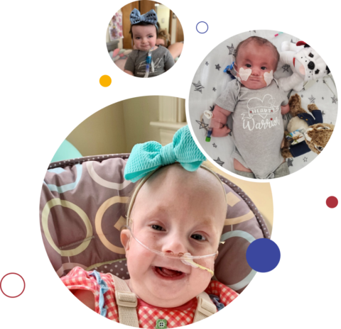 Trisomy 18 Syndrome | Trisomy 13 Syndrome