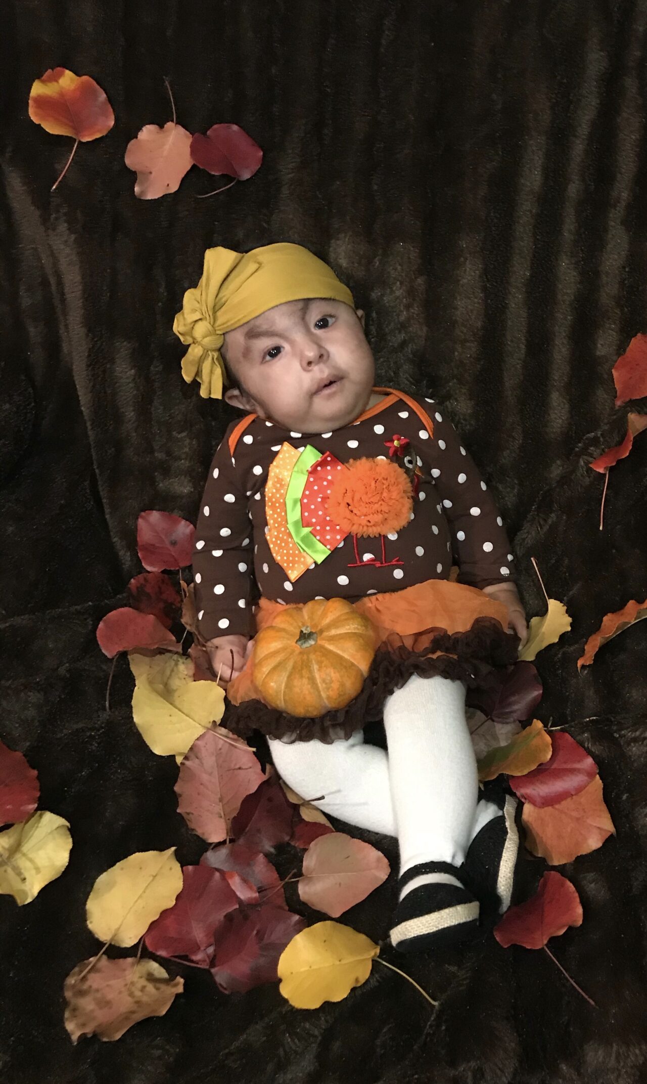 Support Organization for Trisomy | SOFT