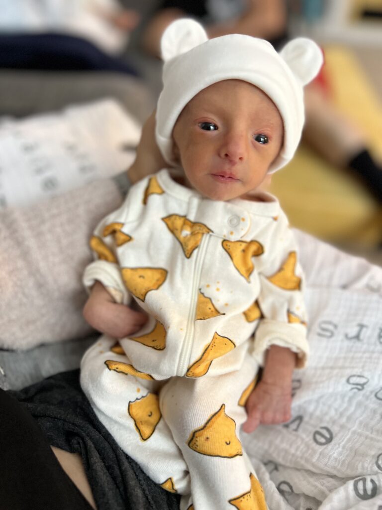 Trisomy Spotlight - Chapman | SOFT