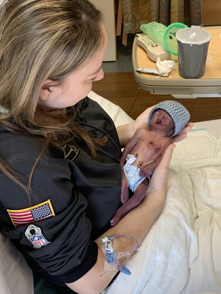 Trisomy Awareness Month Spotlight - Carisa Peterson | SOFT