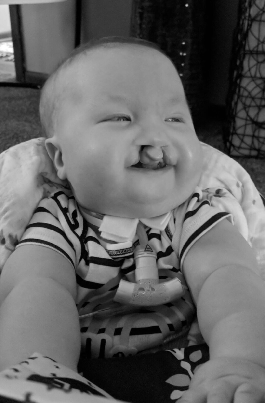 Trisomy Awareness Month Spotlight - Alesha Gibler | SOFT