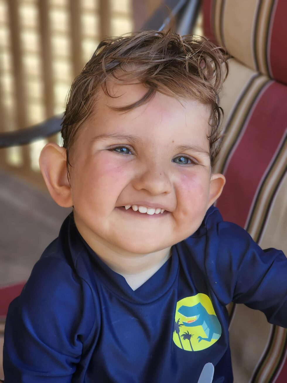 Trisomy 18 Syndrome | Trisomy 13 Syndrome | Trisiomy 9 Syndrome